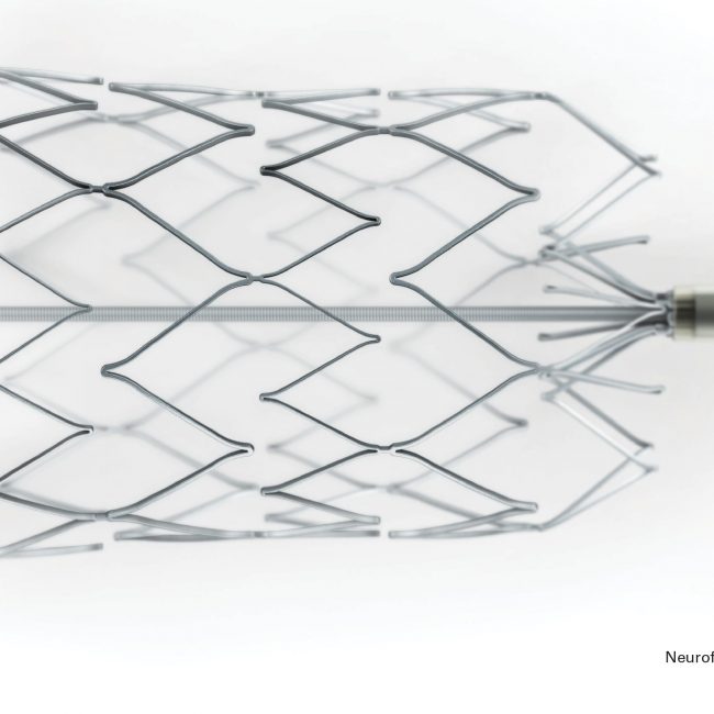 Neuroform Atlas – Endovascular Médica Canarias
