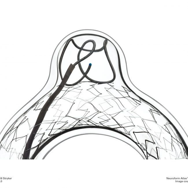 Neuroform Atlas – Endovascular Médica Canarias